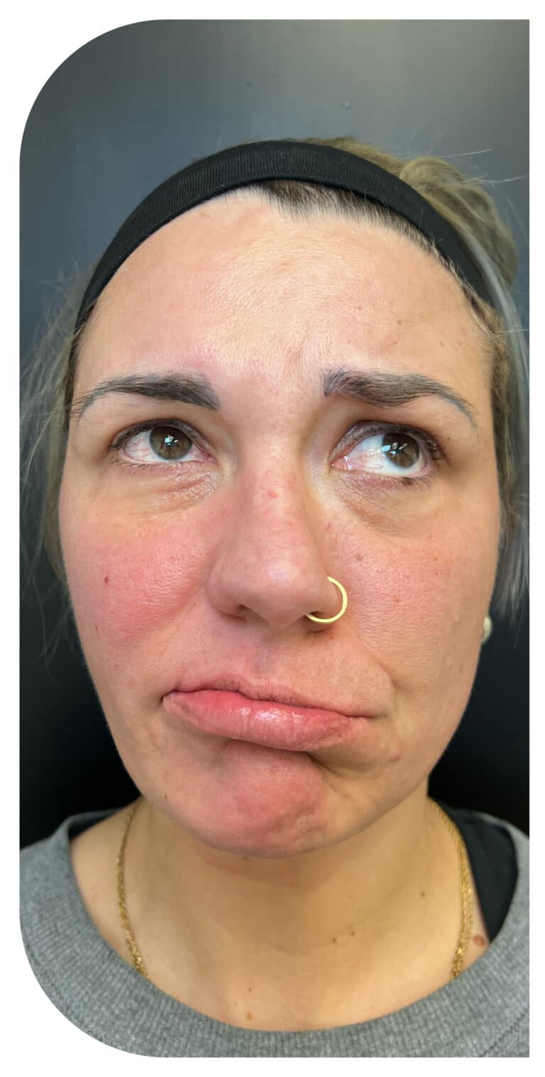 Gallery - FaceIQ MedSpa